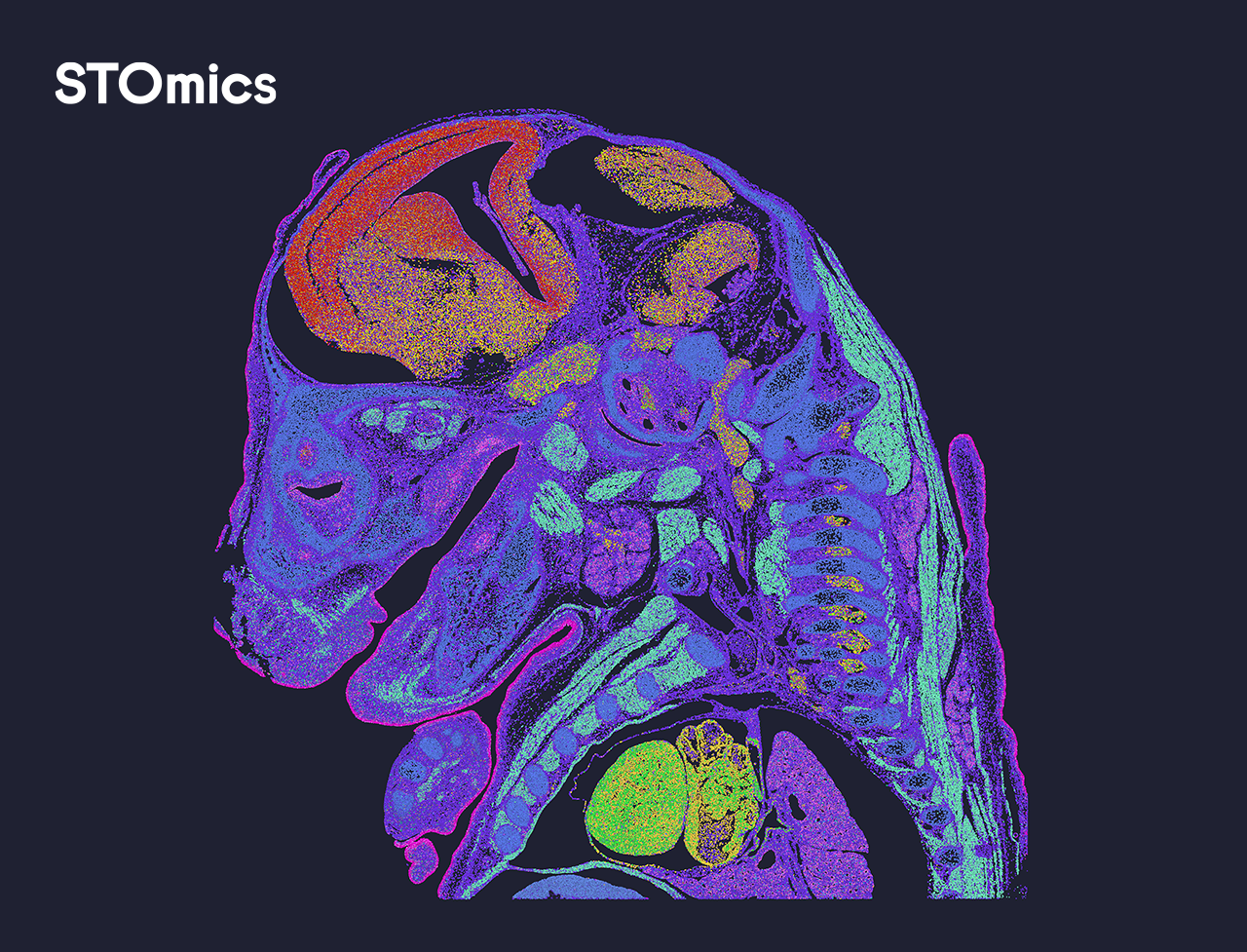 Stereo-seq OMNI for FFPE solution - STOmics